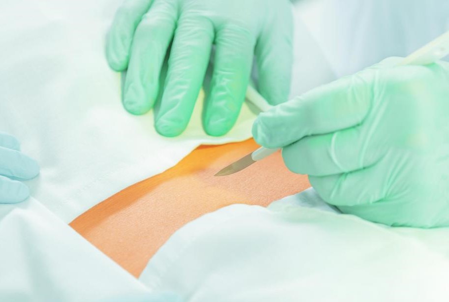 Incision And Drainage Trays Welcome To Busse Hospital Disposables Incision And Drainage Trays Welcome To Busse Hospital Disposables