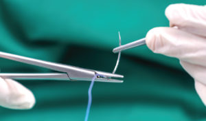 Wound Closure Trays – Welcome to Busse Hospital Disposables